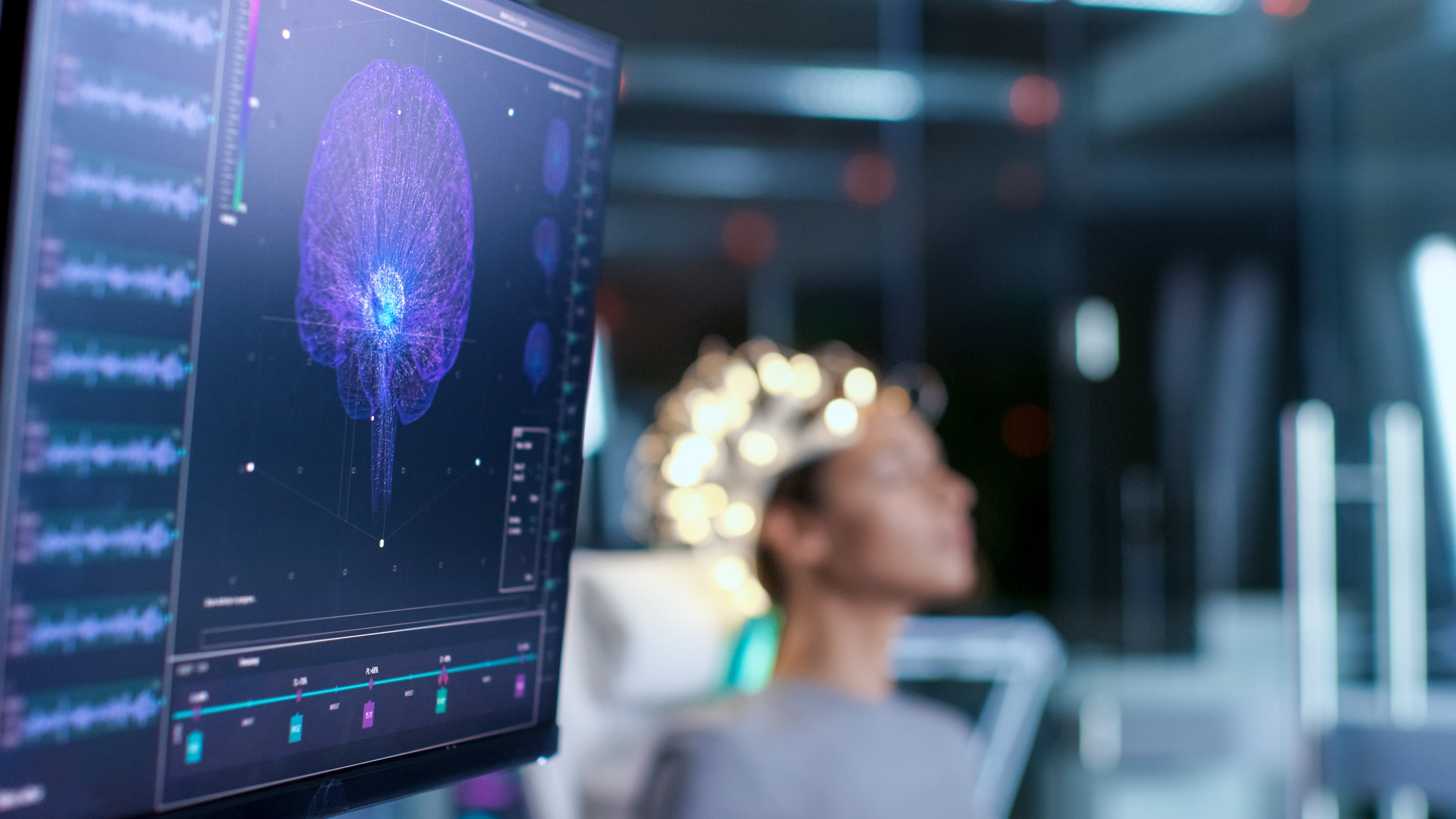 Private EEG | Electroencephalography | OneWelbeck Private EEG | Electroencephalography | OneWelbeck