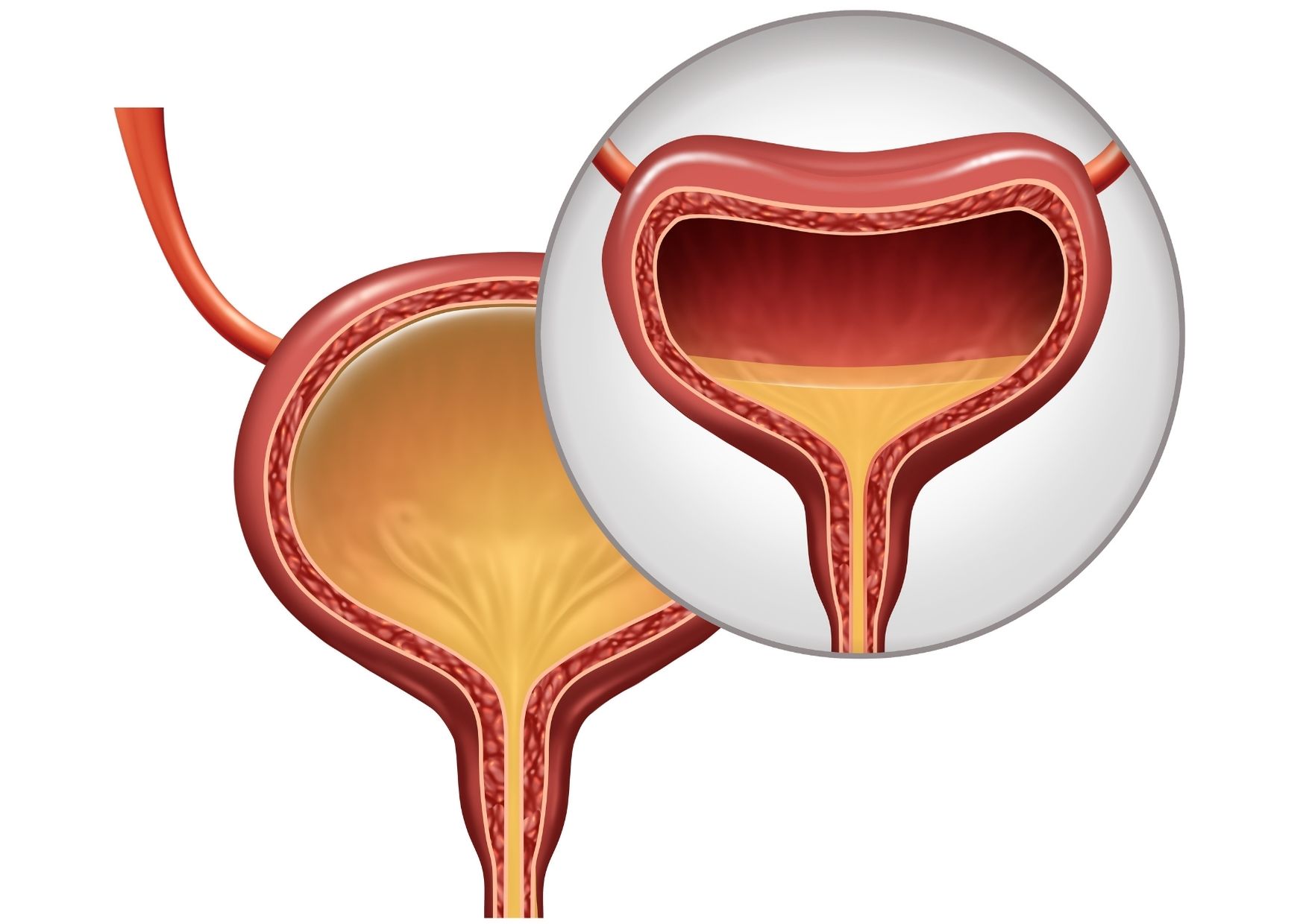 Cystoscopy Tests Treatments OneWelbeck